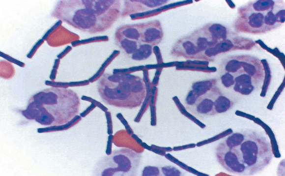 US Army on Anthrax Buying Spee : Indybay